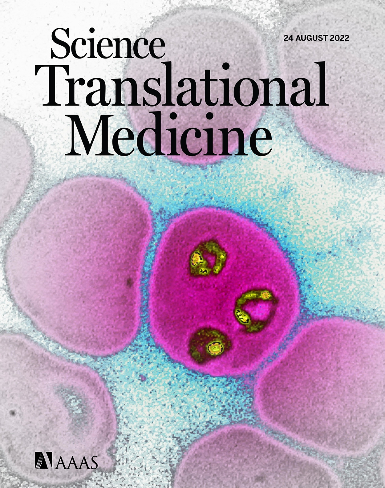 The systemic anti-microbiota IgG repertoire can identify gut bacteria that translocate across ...